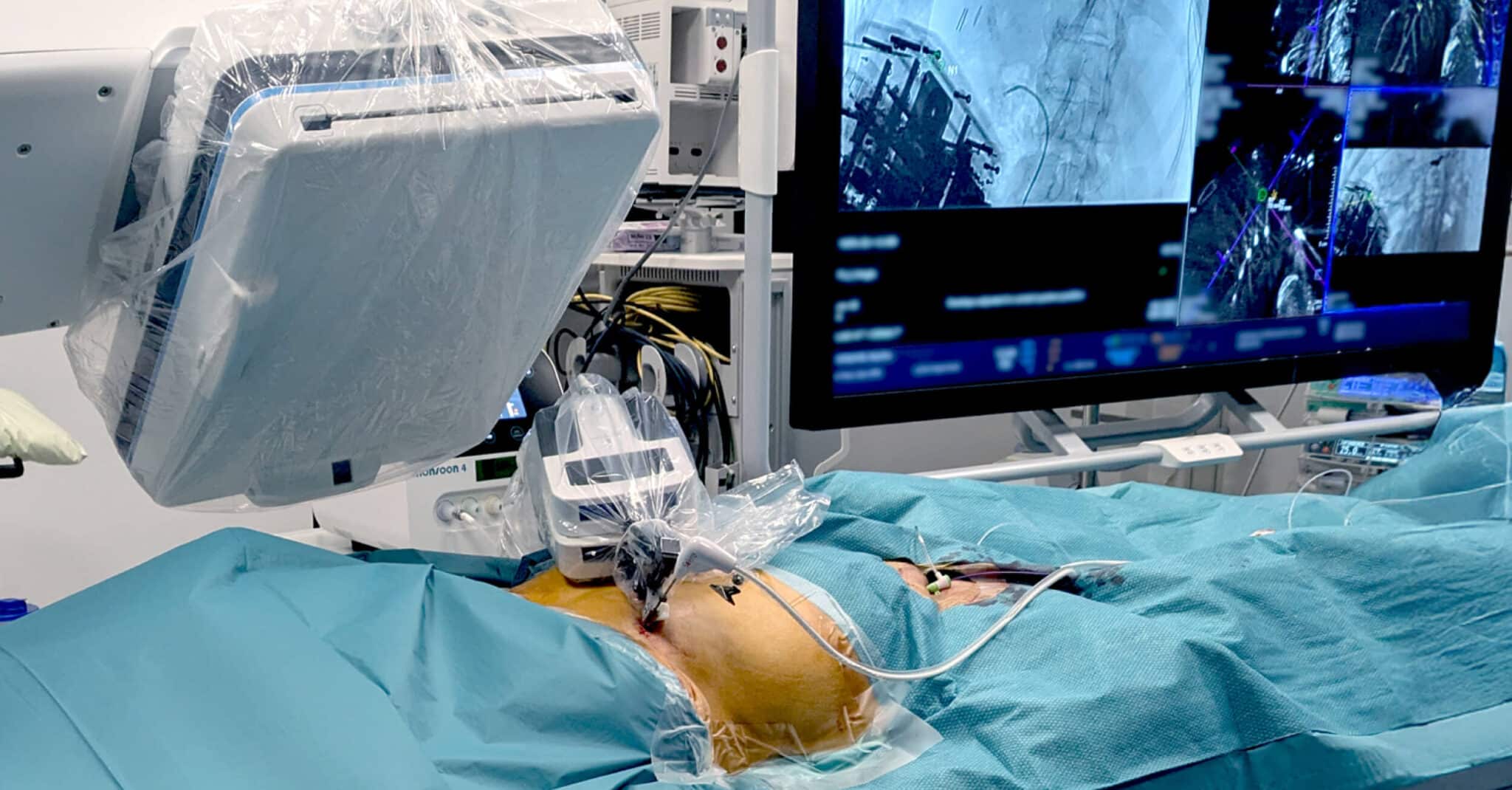Interventional Systems Partners with Siemens Healthineers to Expand ...