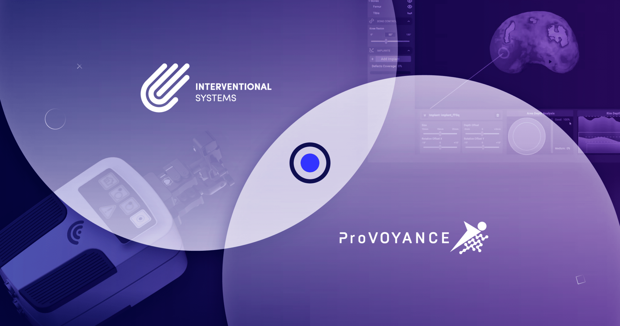Resource center | Interventional Systems